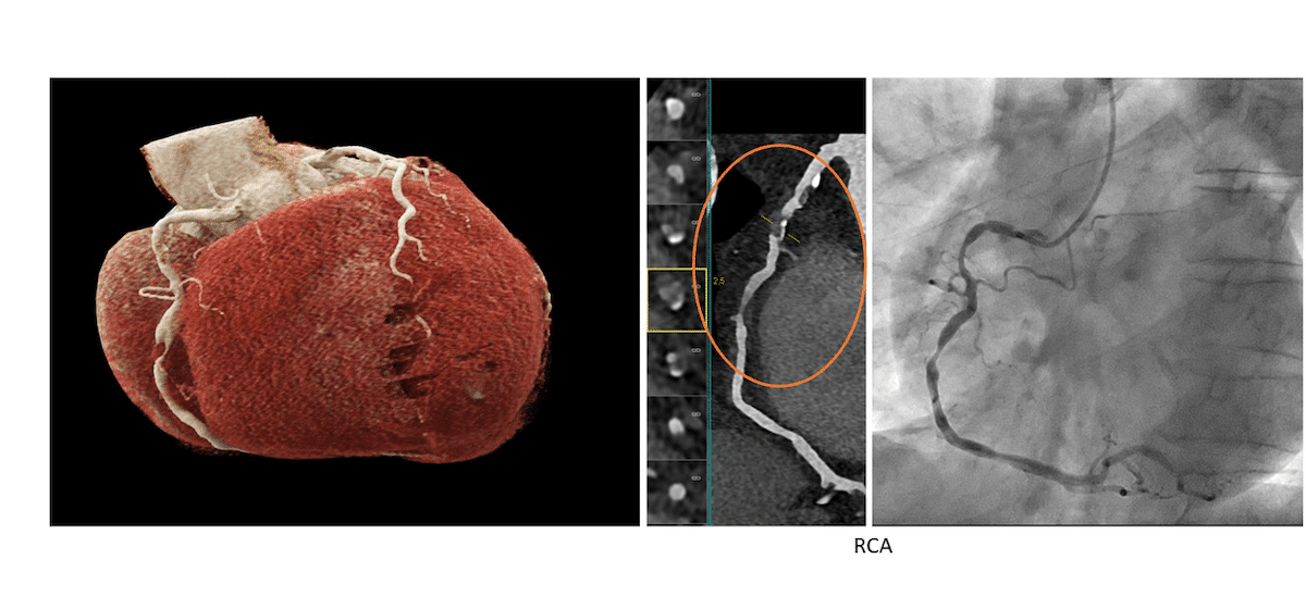 Premier bilan du scanner révolutionnaire du Centre cardio-thoracique de ...